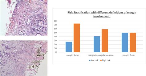 Resection Margin Involvement After Endoscopic Excision Of Malignant Colorectal Polyps