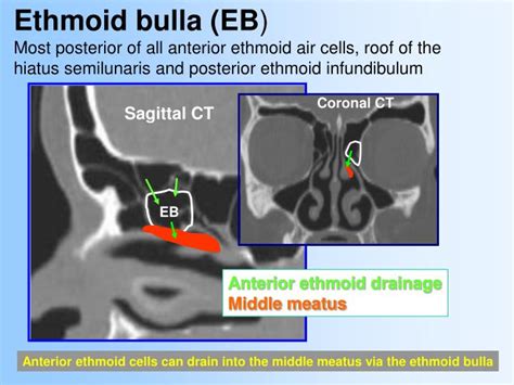 Ppt Anatomy And Relevant Anatomical Variants In Nasal And Paranasal