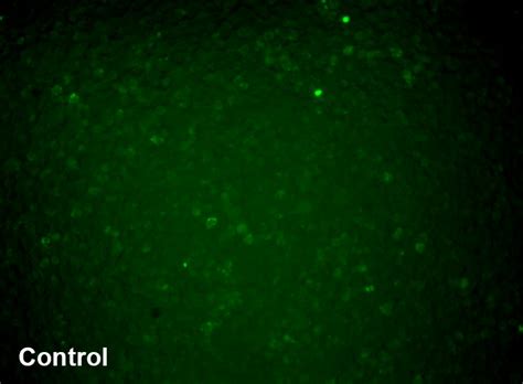 A Novel Fluorescent Probe For Imaging And Detecting Hydroxyl Radical In Living Cells Aat Bioquest