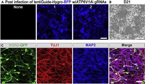 Characterization Of Virus Infection And Ngn2 Neuronal Differentiation Download Scientific