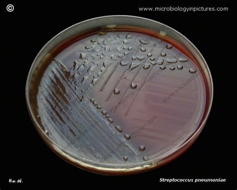Streptococcus Pneumoniae Culture Plate