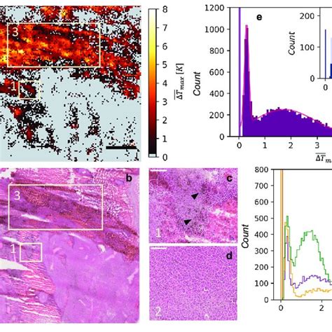 Sub Diffraction Photo Thermal Imaging On B16 Melanoma Biopsies A Download Scientific Diagram