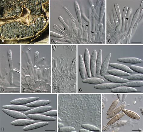 The Botryosphaeriaceae Genera And Species Known From Culture Pmc