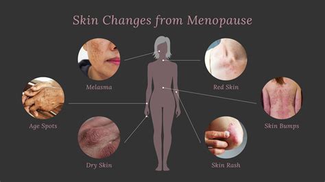 Itchy Skin Are You Menopauseing