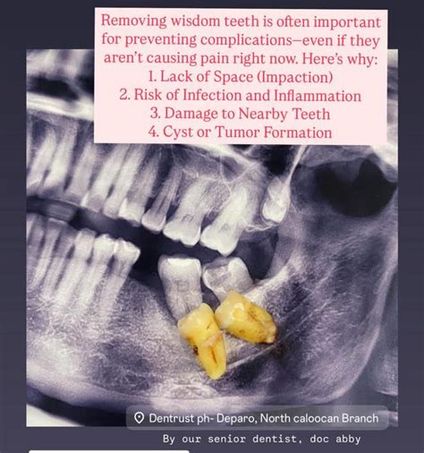 Dentrust Ph Deparo North Caloocan Branch Caloocan
