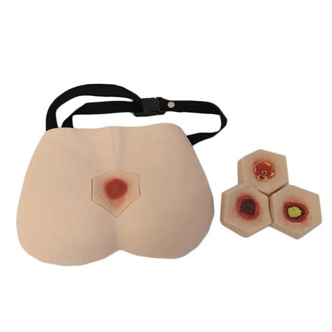 Buy Fxq Stage Decubitus Ulcer Care Model 4 Stages Of Bedsores