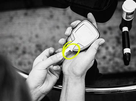 What Is Acute Hyperglycemia Symptoms And Treatment