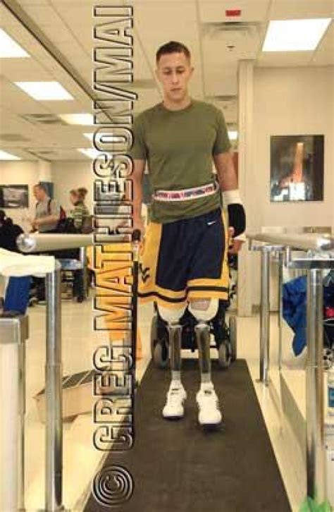 Military Prosthetics The Next Generation Proceedings February 2007
