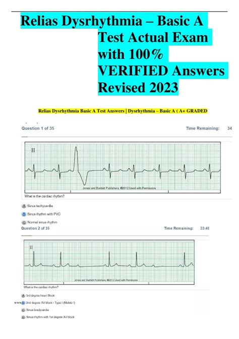 Relias Dysrhythmia Basic A Test Actual Exam With 100 Verified