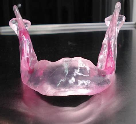 Mandibulectomy Is An Amazing Surgical Procedure That Removes A Small Or Large Part Of Your Lower