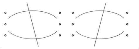 Strabismus And Ocular Motility Demystified Eye News