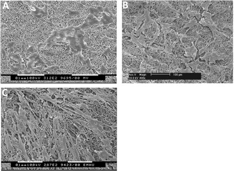 Elastin Based Constructs Intechopen