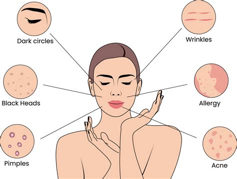 Vector Art Depicting Various Skin Issues Vector Based Guide To Skin