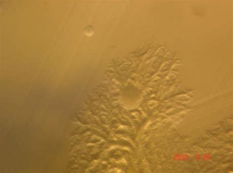 Photomicrograph Of Colonies Of Flavobacterium Like Bacteria Developed