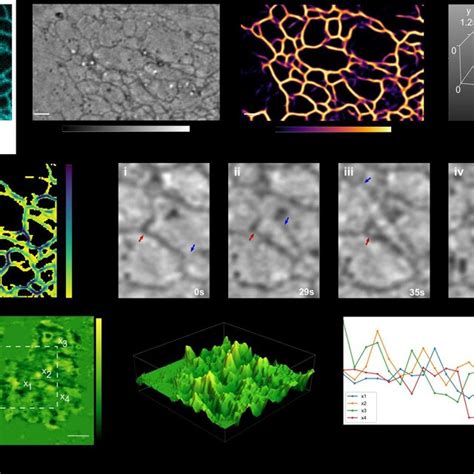Structure And Dynamics Of The Endoplasmic Reticulum A Fluorescence Download Scientific