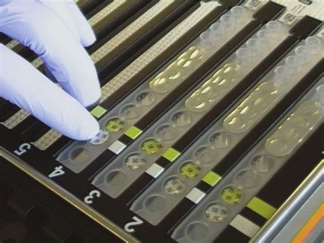 Max Enteric Bacterial Panel Bd