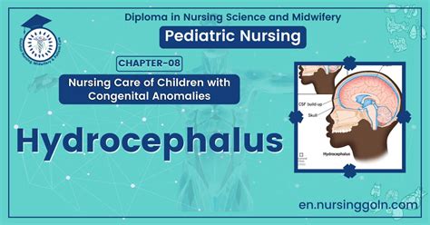 Concept About Hydrocephalus Chapter 8 Pediatric Nursing Nursing