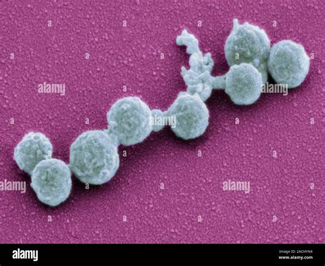 Synthetic Mycoplasma Bacteria Coloured Scanning Electron Micrograph