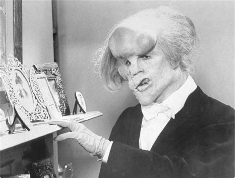 John Merrick Elephant Man Quotes The Extraordinary Life Of Joseph