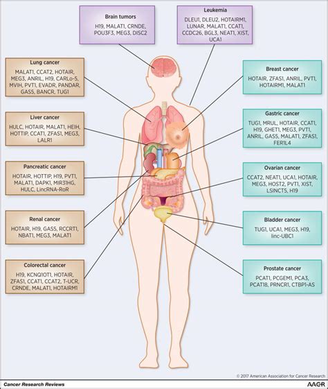 Long Noncoding RNA And Cancer A New Paradigm Abstract Europe PMC