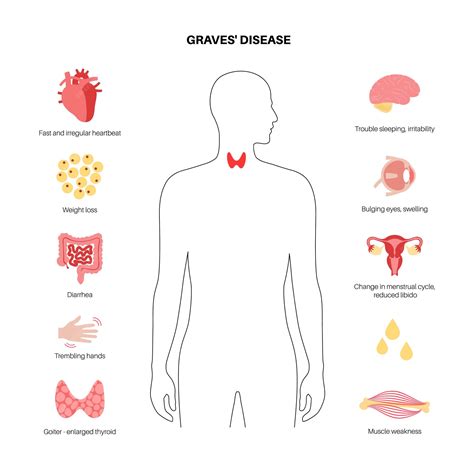 Premium Vector Graves Disease Hyperthyroidism And Immune System Disorder Overactive Thyroid Gland