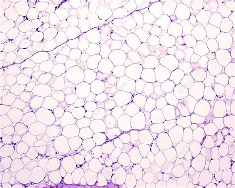 Adipose Tissue Under Microscope