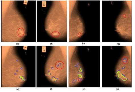 Top Row A D Model Novel Mammograms From The Ddsm Dataset Bottom Download Scientific