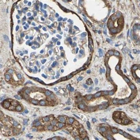 Filamin B Antibody Pa5 52098