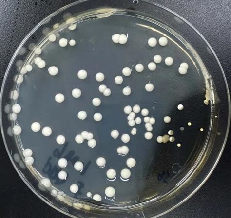 不同标准下的马铃薯葡萄糖琼脂培养基异同 知乎