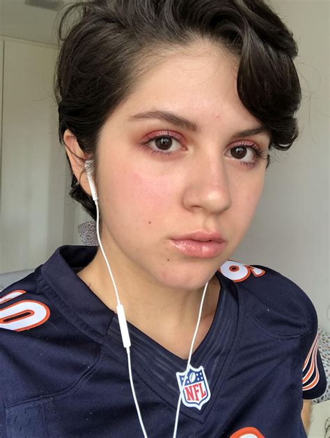 How To Get Rid Of Swollen Cheeks After Wisdom Teeth Removal Trending Now