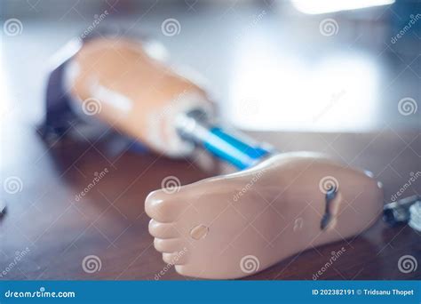 Below Knee Prothesis Stock Image Image Of Equipment 202382191