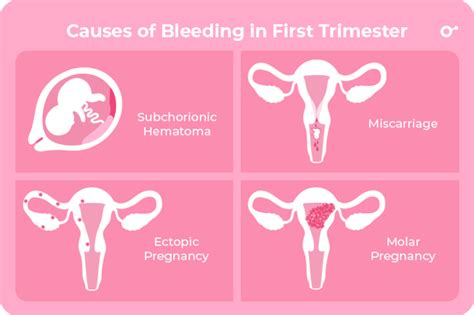 Is Heavy Implantation Bleeding Normal