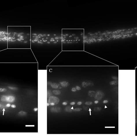 Dapi Staining Of Wild Type Caenorhabditis Elegans Clade 9 The Download Scientific Diagram