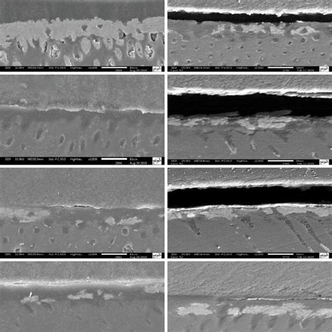 Representative Sem Micrographs Of Silver Nitrate Impregnation