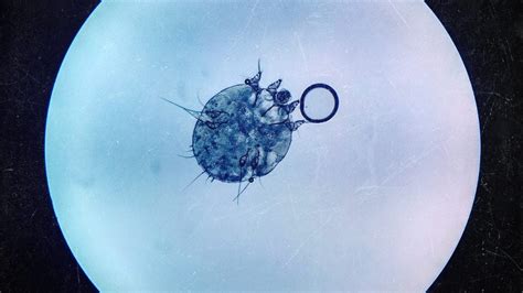 Scabies Mite Microscope