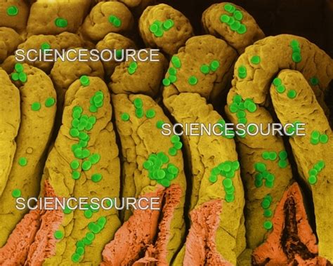 Enterococcus Faecium On The Small Inte Stock Image Science Source Images