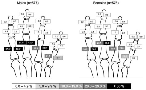Osteo Proliferative Lesions Of The Phalanges On Radiography