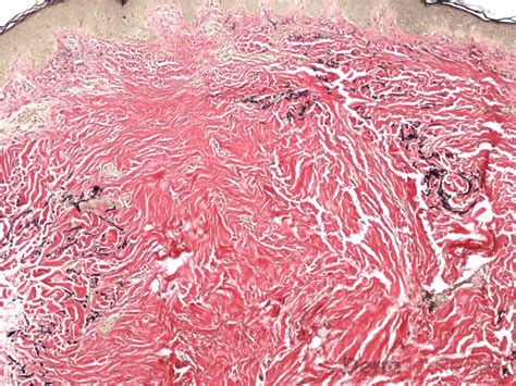 Figure 5 9 13 Derm In Review