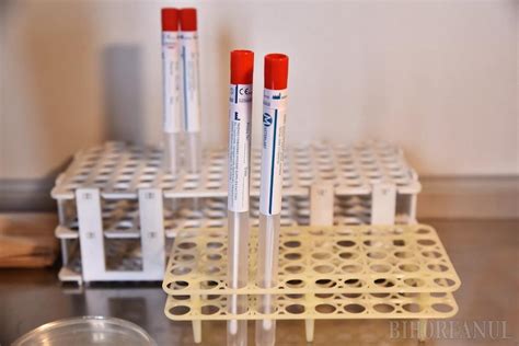 The Importance And Implications Of Hpv Testing For Womens Health