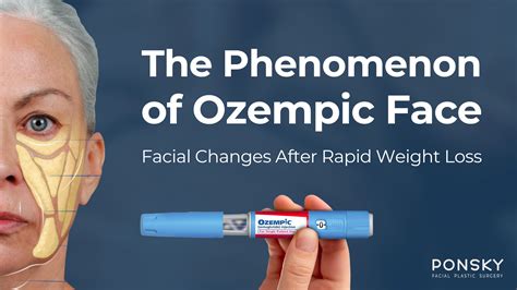 Ozempic Face Changes Dr Diana Ponsky Facial Plastic Surgery