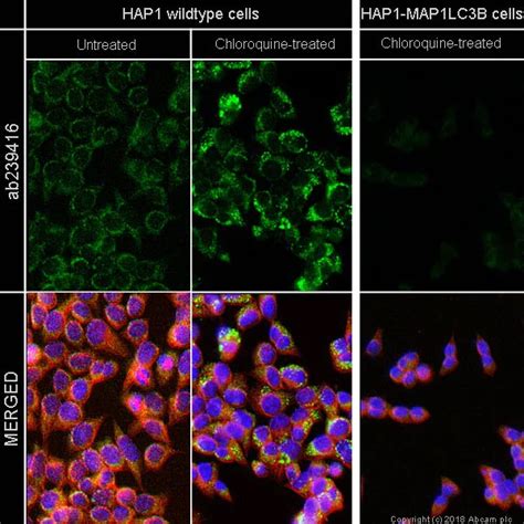 Anti Lc3b Antibody Epr21235 Ab239416 Abcam