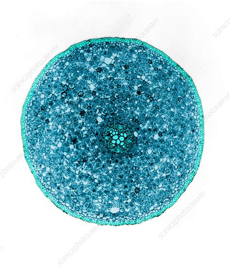 Ranunculus Root Lm Stock Image C0283916 Science Photo Library