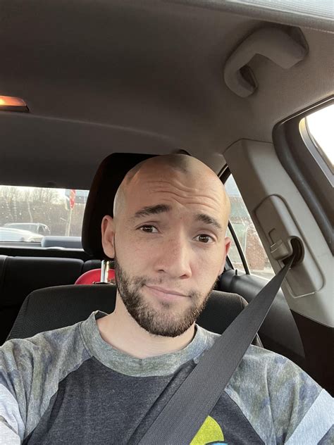 Hormone Questions R Bald
