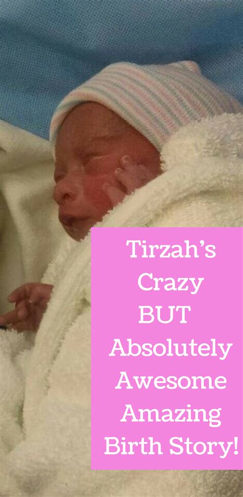 11 Pierre Robin Sequence Ideas Charles Bonnet Syndrome Rockin Robin Piano Sheet Music