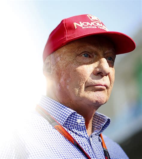 Niki Lauda Before And After