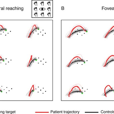 Y Deviations Of Reaching Trajectory Toward Targets Along The Horizontal