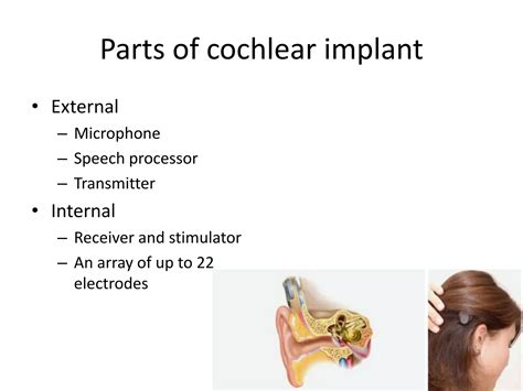 Cochlear Implantation Over View Pptx