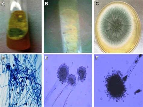 Aspergillus Flavus Culture