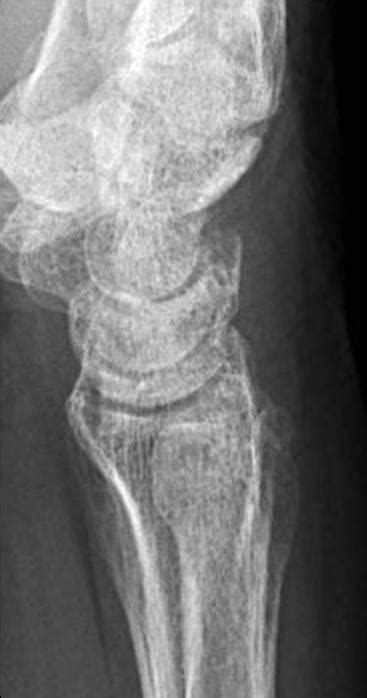 Musculoskeletal Joints And Tendons 63 Wrist And Carpus Case 637