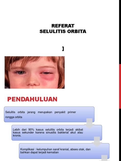 Ppt Selulitis Orbita 1 Pdf Kajian Bahasa Asing Kesehatan Holistik